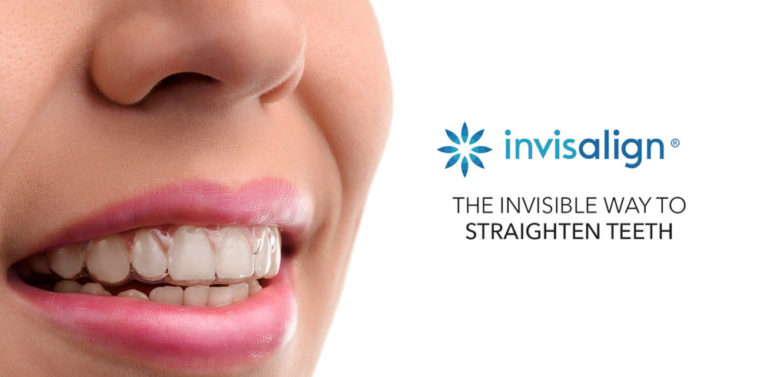 Invisalign Templestowe Templestowe Dental Clinic